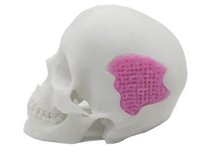3d printed bones ossiform when released